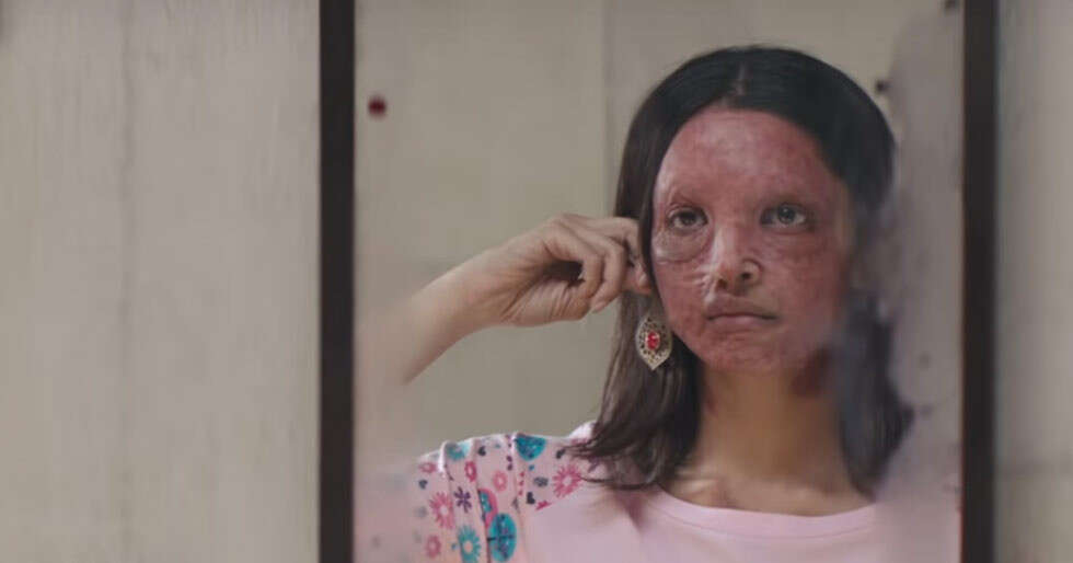 Chhapaak Trailer Review | Filmfare.com